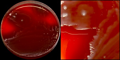 Proteus vulgaris and Escherichia coli – new images | VetBactBlog